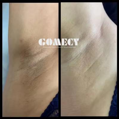 China Germany Triple Wavelength Diode Laser Hair Removal Machine 4 Wave 808 755 940 1064nm Diode Ice 2in1 Diode Laser Hair Removal Machine for sale