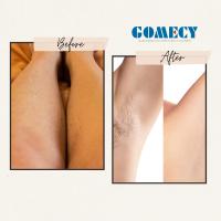 China Painless Diode Hair Removal Machine for sale