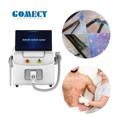 China GOMECY 2024 Ai Skin Analysis Hair Removal Diode Laser Machine Ice Titanium 4 Waves 755 808 1064nm for sale