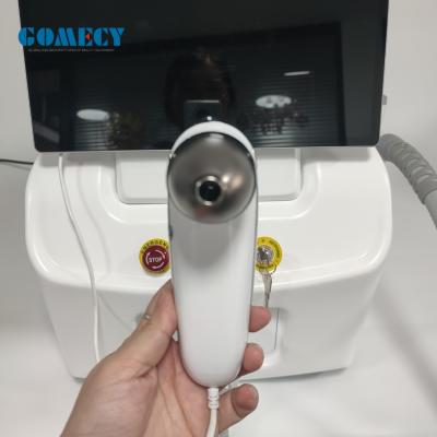 Cina Ultimo design 2025, laser a diodi 2 in 1 efficace e potente per la rimozione dei peli, con funzione di rilevamento dei capelli per il test del cuoio capelluto in vendita