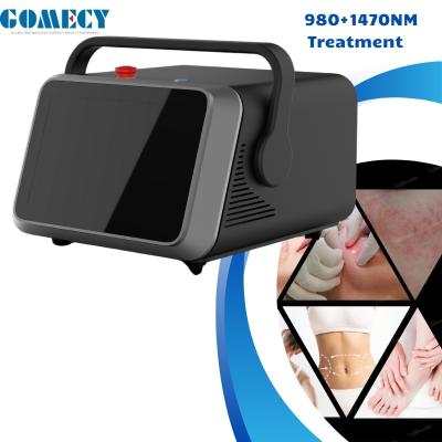 중국 635nm 980nm 1470nm 3파파선 다이오드 레이저 얼굴 리프트 지방분석 체력 절감 체중 감량 치료 장비 판매용