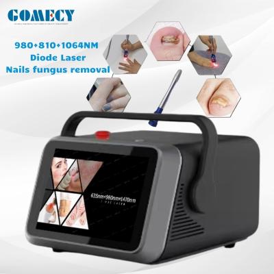 중국 Gomecy ODM OEM 의료용 다이오드 레이저 635nm 치유 980nm 1470nm 항염증 신체 치료 수술 장비 판매용