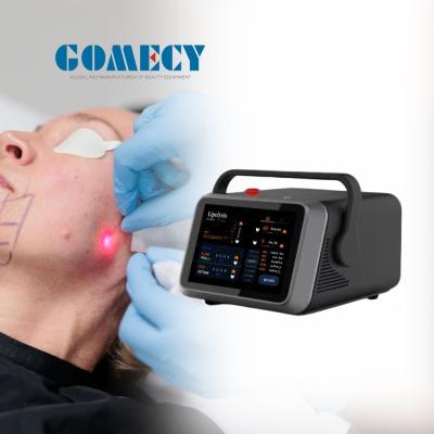 China Endolaser 1470nm Diode Laser 200 Micron Bare Fibre Lipolysis Endolifting Fiber Lifting Machine for sale