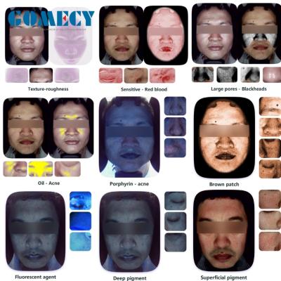 China GMS- A6 Máquina analizadora facial inteligente con 8 tecnologías de imagen espectral para el análisis con un clic de 15 problemas de la piel en venta