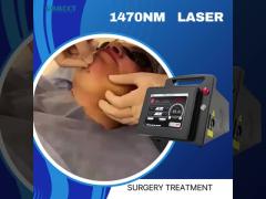 GOMECY 1470nm 980nm/30W Reduzir gordura Endolift Dispositivo a laser Endolaser Máquina Redutora de Celulite de Gordura