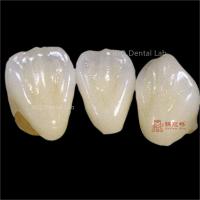 Quality Polished Glazed Zirconia Reduced Plaque Accumulation Clinical Friendly Design for sale