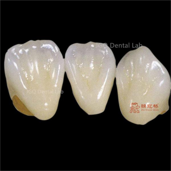 Quality Polished Glazed Zirconia Reduced Plaque Accumulation Clinical Friendly Design for sale