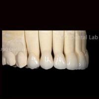 Quality Customized Chinese Dental Lab Zirconia Teeth Precision Overall Dental Restoratio for sale
