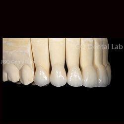 Quality Customized Chinese Dental Lab Zirconia Teeth Precision Overall Dental Restoration for sale