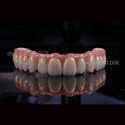 China Titanium Abutment Dental Implant Screw Retained Crown 3D Laser Printing Customized for sale