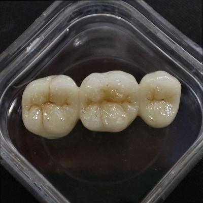 China Ceramic Zirconia Dental Lab Crown Custom Anterior Posterior Teeth Replacement for sale