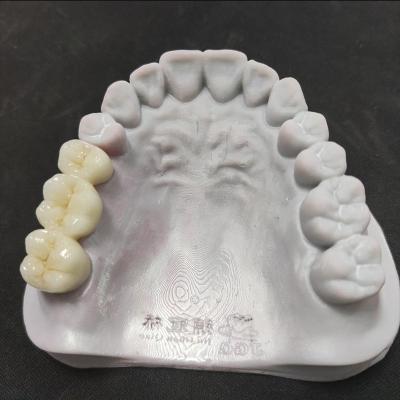 China Dental Impression and Oral Scan Supported China Dental Lab Custom Tailor Zirconia Crowns for sale
