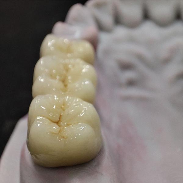 Quality Custom China Dental Lab Hand Tailor Full Ceramic Crowns Free End for sale