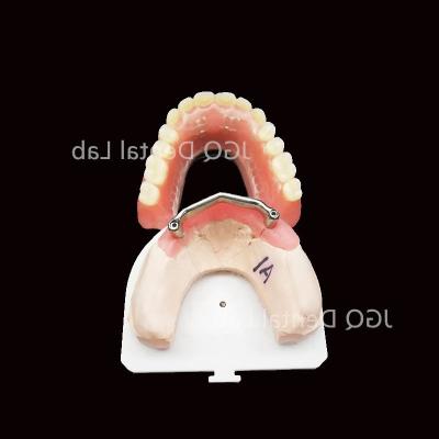 China Customized Hybrid Dental Implants Hybrid Denture With Titanium Bar for sale