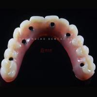 Quality Snap in Implant Dentures Hybrid Dental Implant Restoration Screwed Retention for for sale