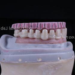 China Dental Lab Durability Implants Make Cost-Effective Option in The Long Run for sale