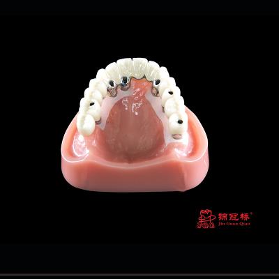 China Dental Implants Restoration Dental Zirconia Screw Crown Implant for sale