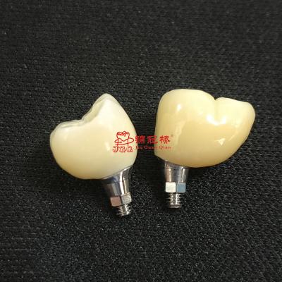 China Customized Dental Crown and Implant with CE FDA Certification Using 3D Laser Printing Technology for sale