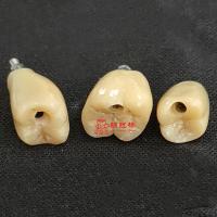 Quality Dental Implant Supported Dentures Retentive Natural Looking Lab China for sale