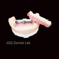 Quality All on 4 Dental Implant Titanium Bar Dentures Restorations for sale