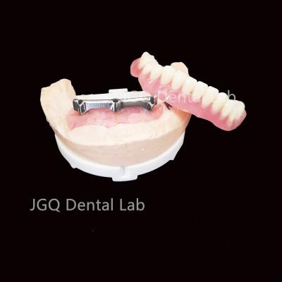 China All on 4 Dental Implant Titanium Bar Dentures Restorations for sale