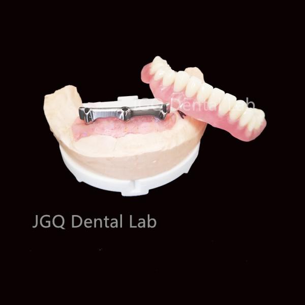Quality All on 4 Dental Implant Titanium Bar Dentures Restorations for sale