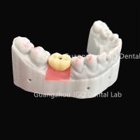 Quality Customized Titanium Dental Abutment Implant with 3D Laser Printing for sale
