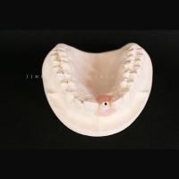 Quality Dental Zirconia Custom Abutment Lab Precise Esthetical As Strong As Titanium for sale
