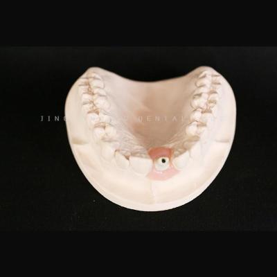 China Dental Zirconia Custom Abutment Lab Precise Esthetical As Strong As Titanium for sale