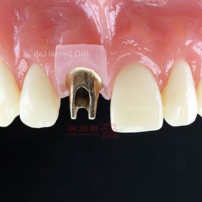 China Titanium Zirconia Custom Dental Abutments for Dental Restoration for sale