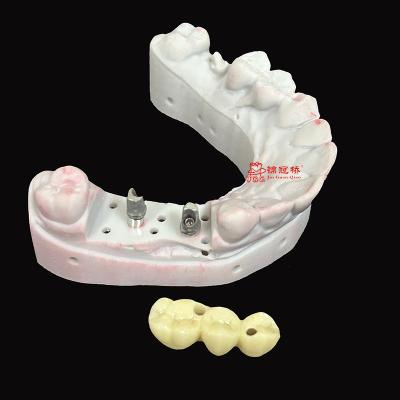 China Dental Implants Custom Titanium Abutment Corrosion Resistant FDA Certification for sale