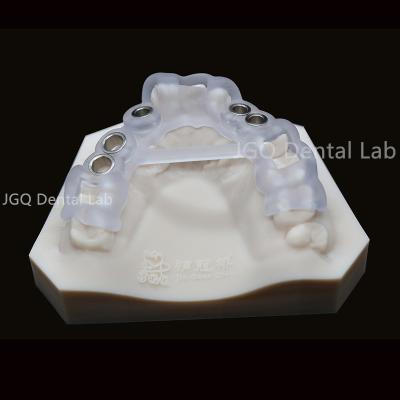 China Dental Lab Customized Surgical Guide For Dental Implants 3D Laser Printing for sale