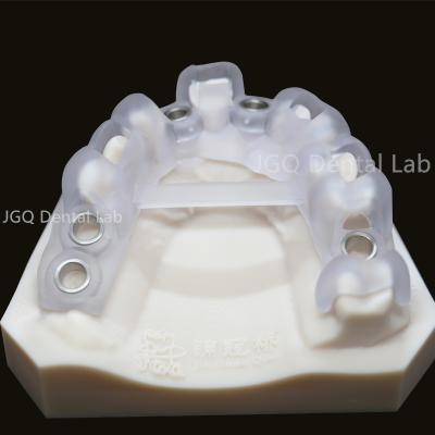 China Digital Tooth Supported Surgical Guide For Dental Implants 3D Printed for sale