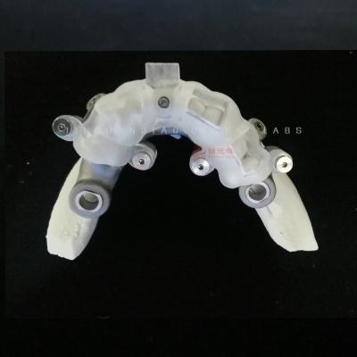 China 3D Printing Tooth Supported Digital Surgical Guide Plate En China Dental Lab for sale