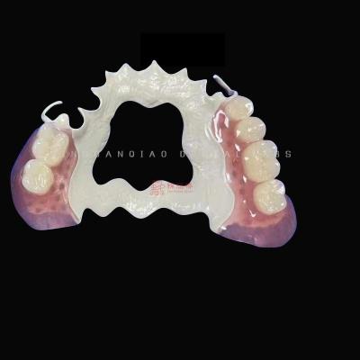China 3D Printing Peek Frame Removable Dentures Acrylic Teeth China Dental Lab for sale