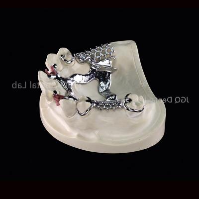 China 3D Printing Co Cr Alloy Removable Denture Framework Customized for Oral Restoration for sale