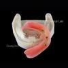 China High Precise Ball Attachment Dentures China Dental Lab Customized for sale