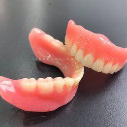 China Medical Grade Acrylic Material Removable Full Dentures Dental Lab for sale