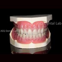 China Natural Looking Removable Partial Dentures Customized for Daily Functions for sale