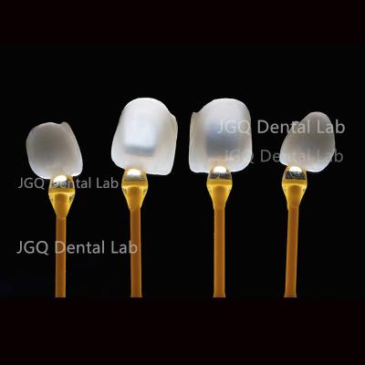 China High Translucency Cast Porcelain Emax Veneers China Dental Lab OEM for sale