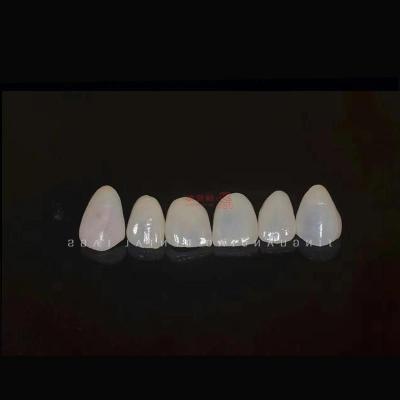 China Tooth Like Shells Dental Porcelain Emax Veneers Dsd Design China Dental Lab for sale