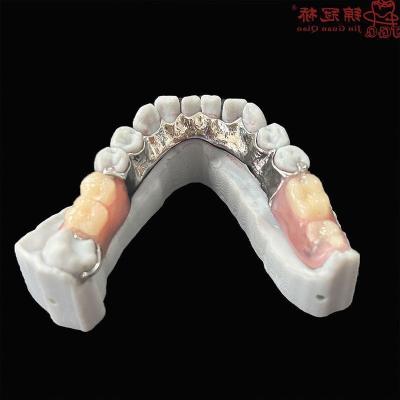 China Co Cr Alloy Removable Dentures DSD Aesthetic Design Acrylic Dentures Customized for sale
