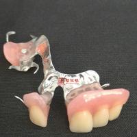 China 3D Printing Co Cr Alloy Removable Denture Framework With Acrylic Teeth for sale