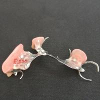 China 3D Printing Co Cr Alloy Removable Denture Framework With Acrylic Teeth for sale