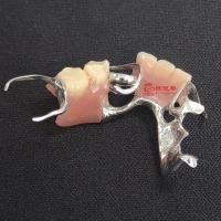 China 3D Printing Co Cr Alloy Removable Denture Framework With Acrylic Teeth for sale