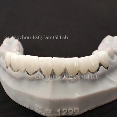 China Premium Aesthetic and Functional Zirconia Integrated Dental Restoration Craft for sale