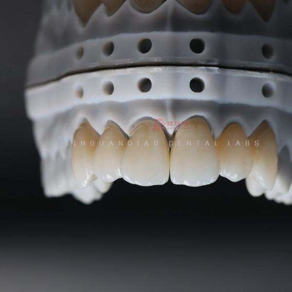Quality Aesthetic Layered  Monolithic Bulk Zirconia Customizable to Your Clinic Needs for sale