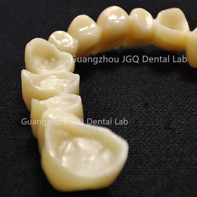China Custom Solid Layered Zirconia Crown Bridge Full Service China Dental Lab for sale