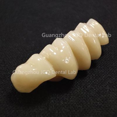 China China Leading Dental Lab Supply High Quality Bulk Zirconia Restorations with Reliable Outsourcing Services for sale
