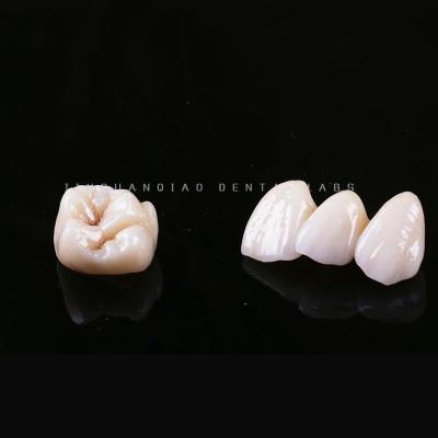 China Custom Dental Lab Zirconia Crown Bridge Fabrication Stable Restoration for sale